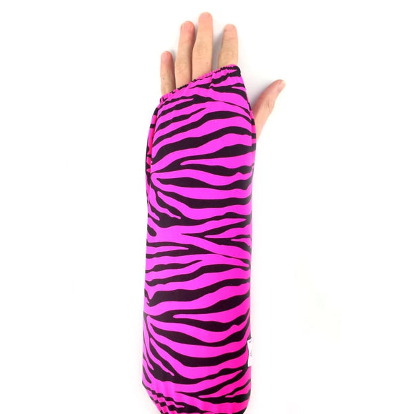 Pink Arm Cast